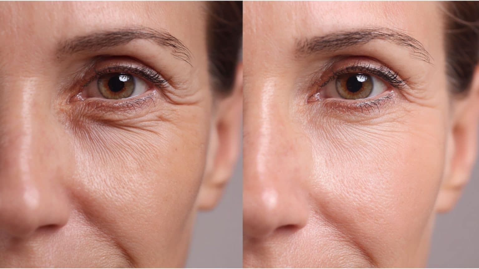 PRP Under Eye Treatment: Your Complete Guide - Copenhagen Fashion Summit